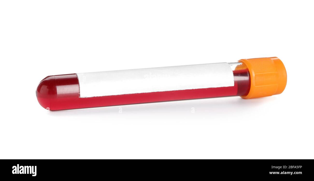 Test tube with blood sample on white background Stock Photo - Alamy