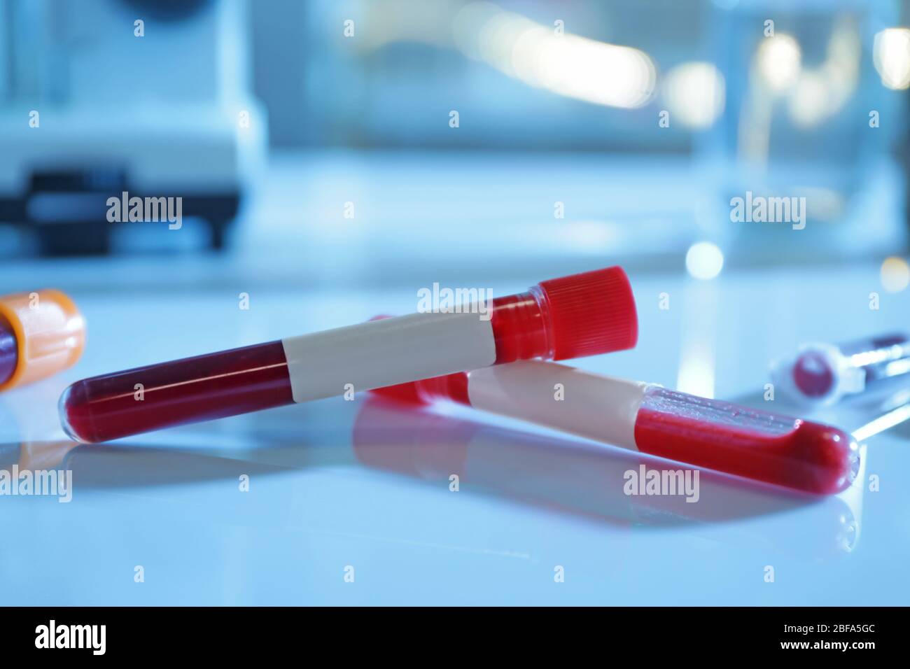 Test tubes with blood samples on table in laboratory Stock Photo - Alamy