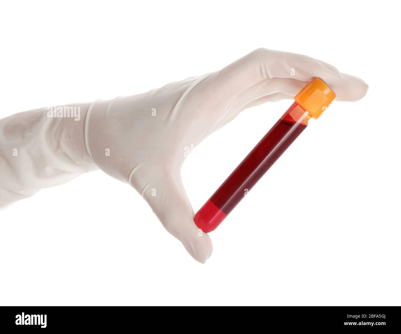 Doctor's hand holding test tube with blood sample on white background ...
