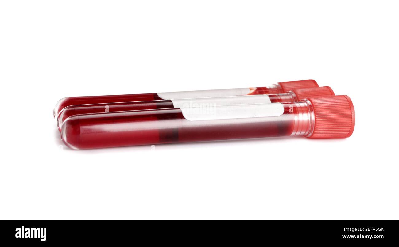 Test tubes with blood samples on white background Stock Photo - Alamy