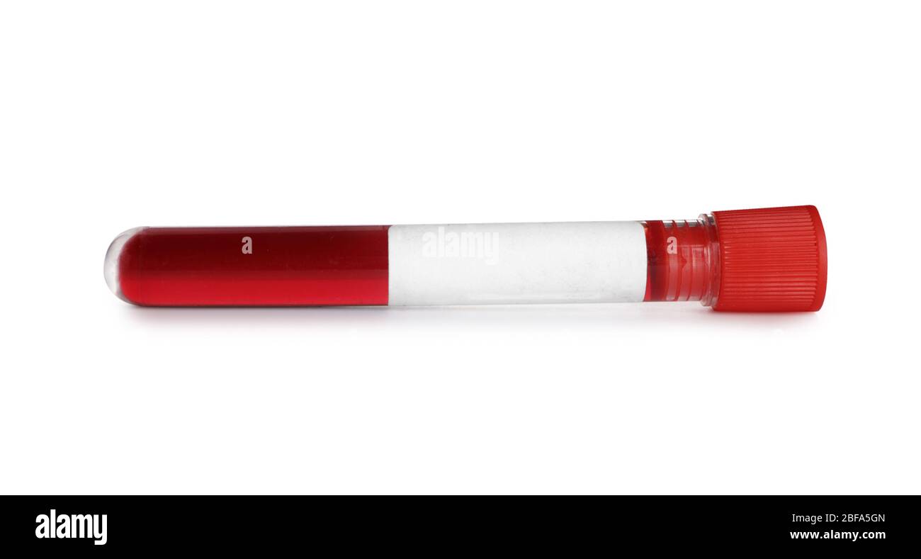 Test tube with blood sample on white background Stock Photo - Alamy