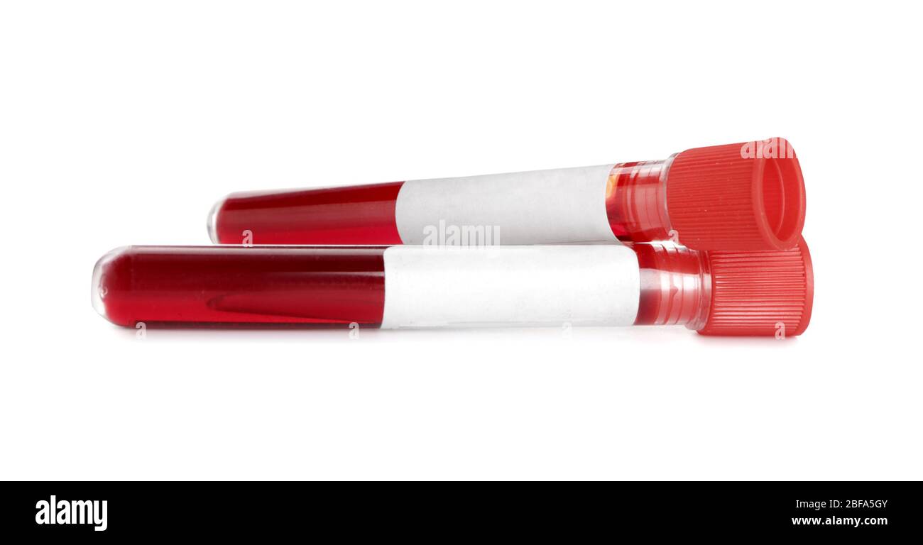 Test tubes with blood samples on white background Stock Photo - Alamy