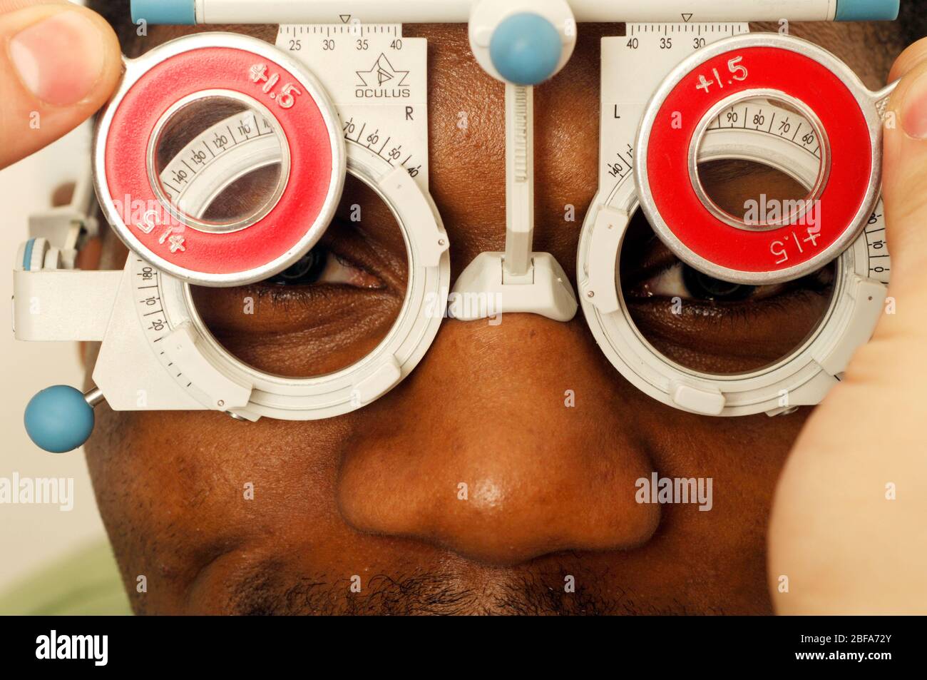 A trial frame is used to find the best lens for a patient with a ...