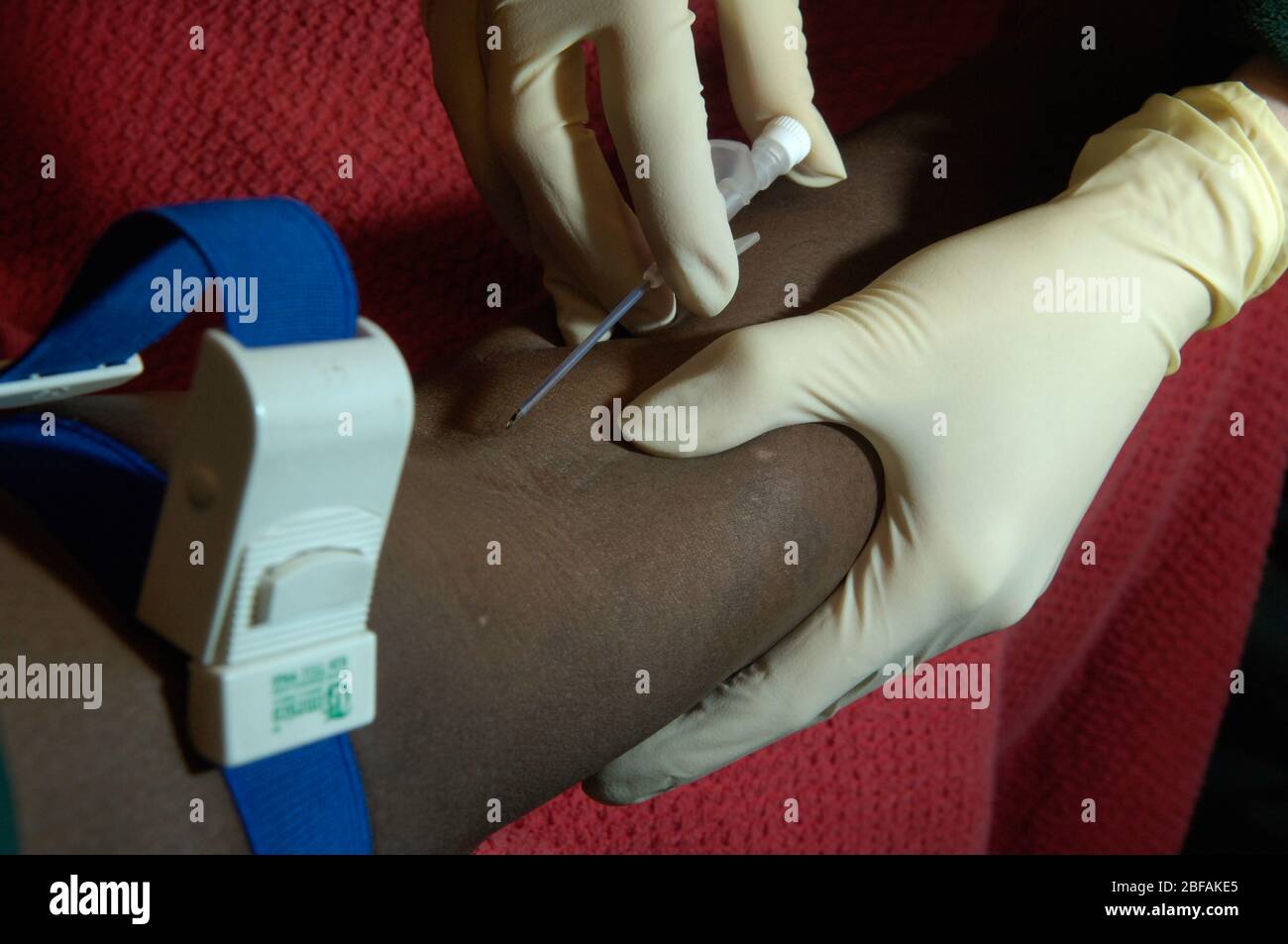 Inserting catheter hi-res stock photography and images - Alamy