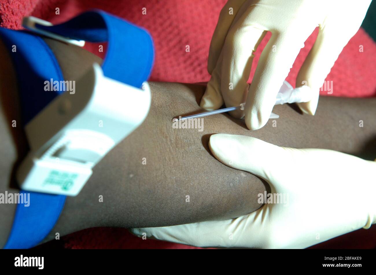 A gloved hand inserts a bore needle into a patients arm Stock Photo - Alamy