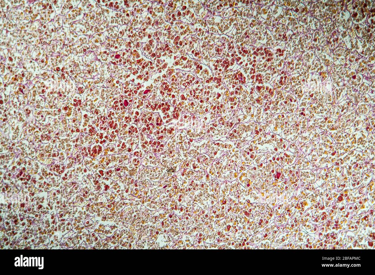 Pituitary gland microscope hi-res stock photography and images - Alamy