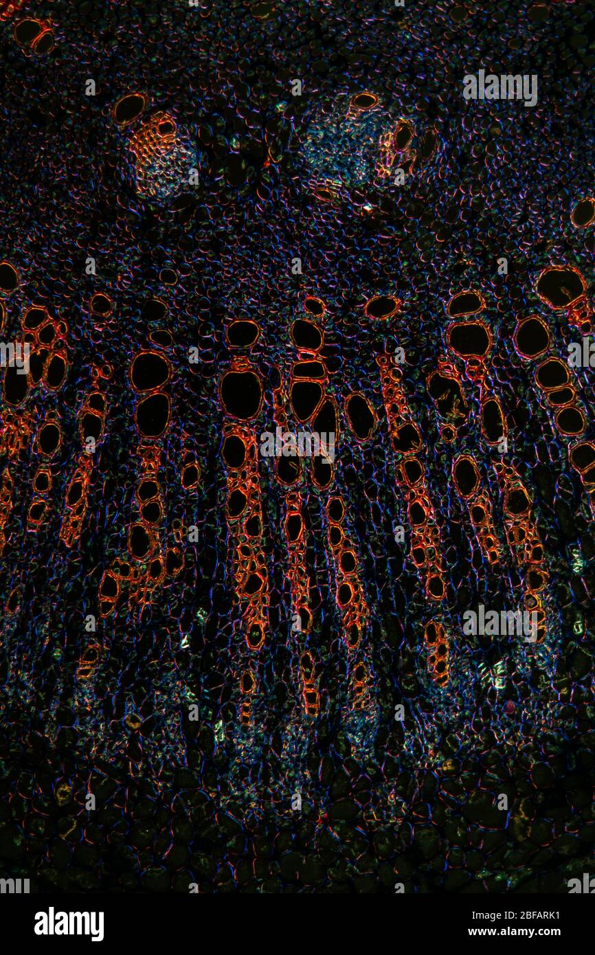 Bean stalk in cross section 100x Stock Photo - Alamy