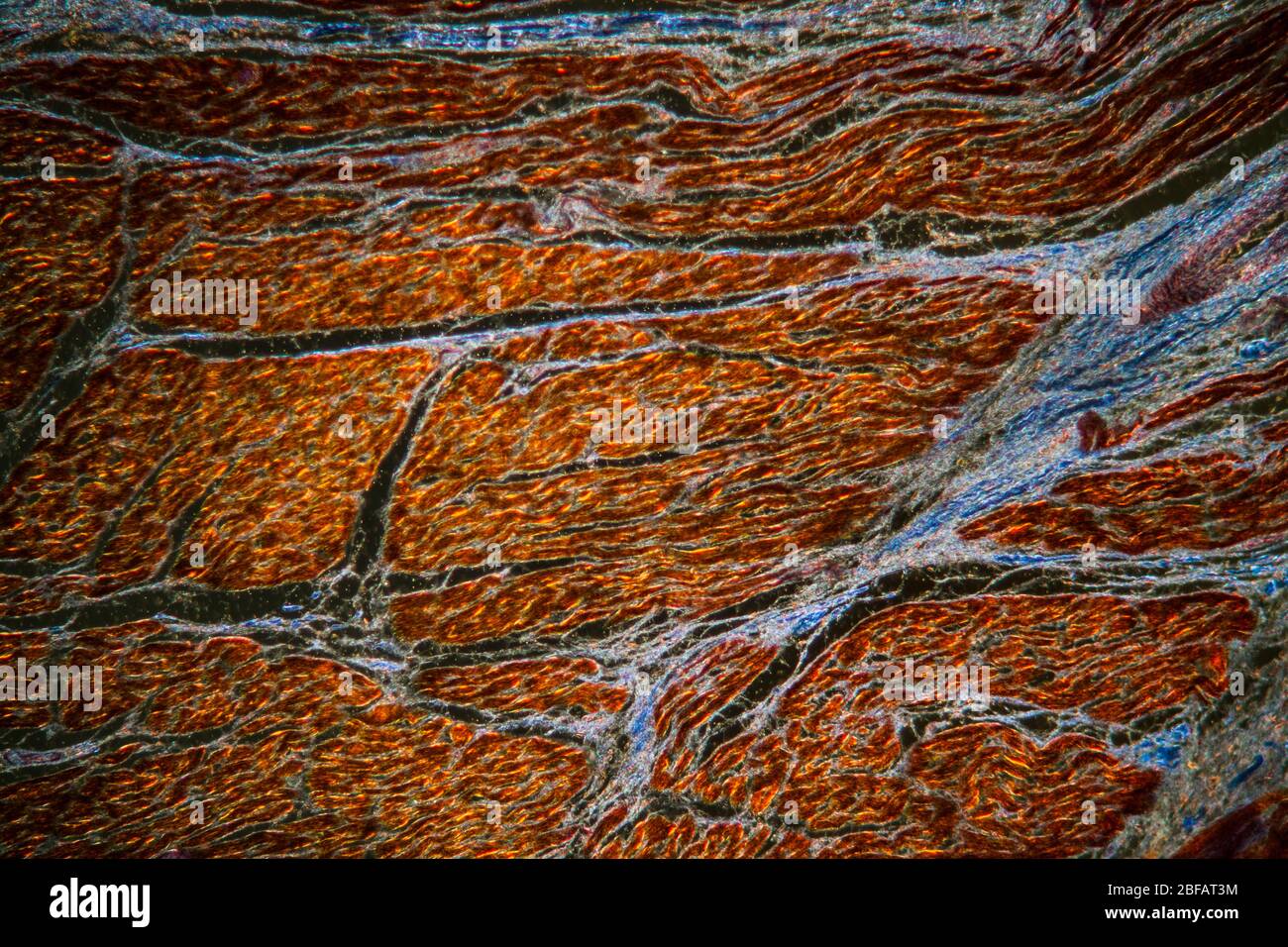 Muscle tissue with collagen increases 100x Stock Photo - Alamy