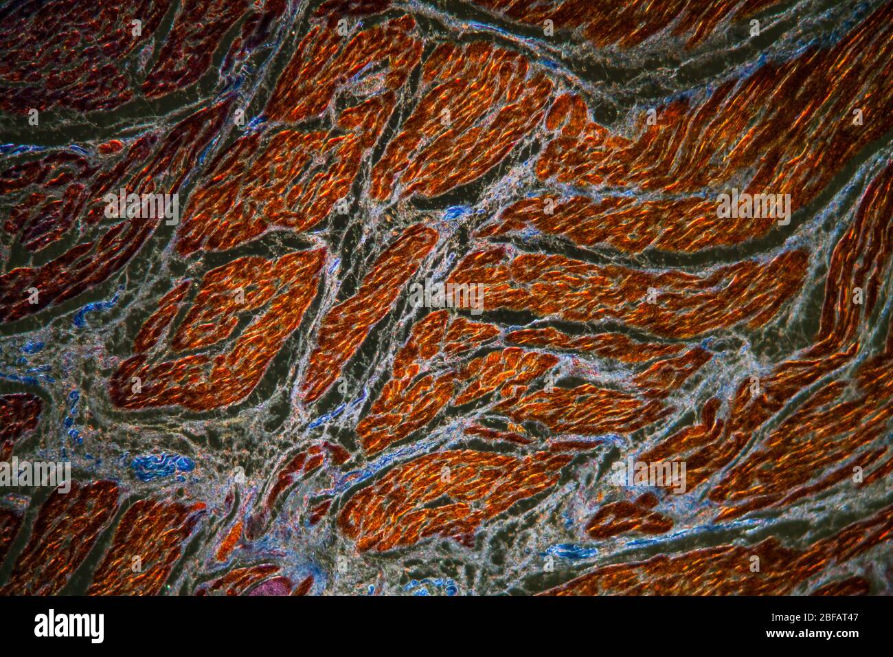 Muscle tissue with collagen increases 100x Stock Photo - Alamy