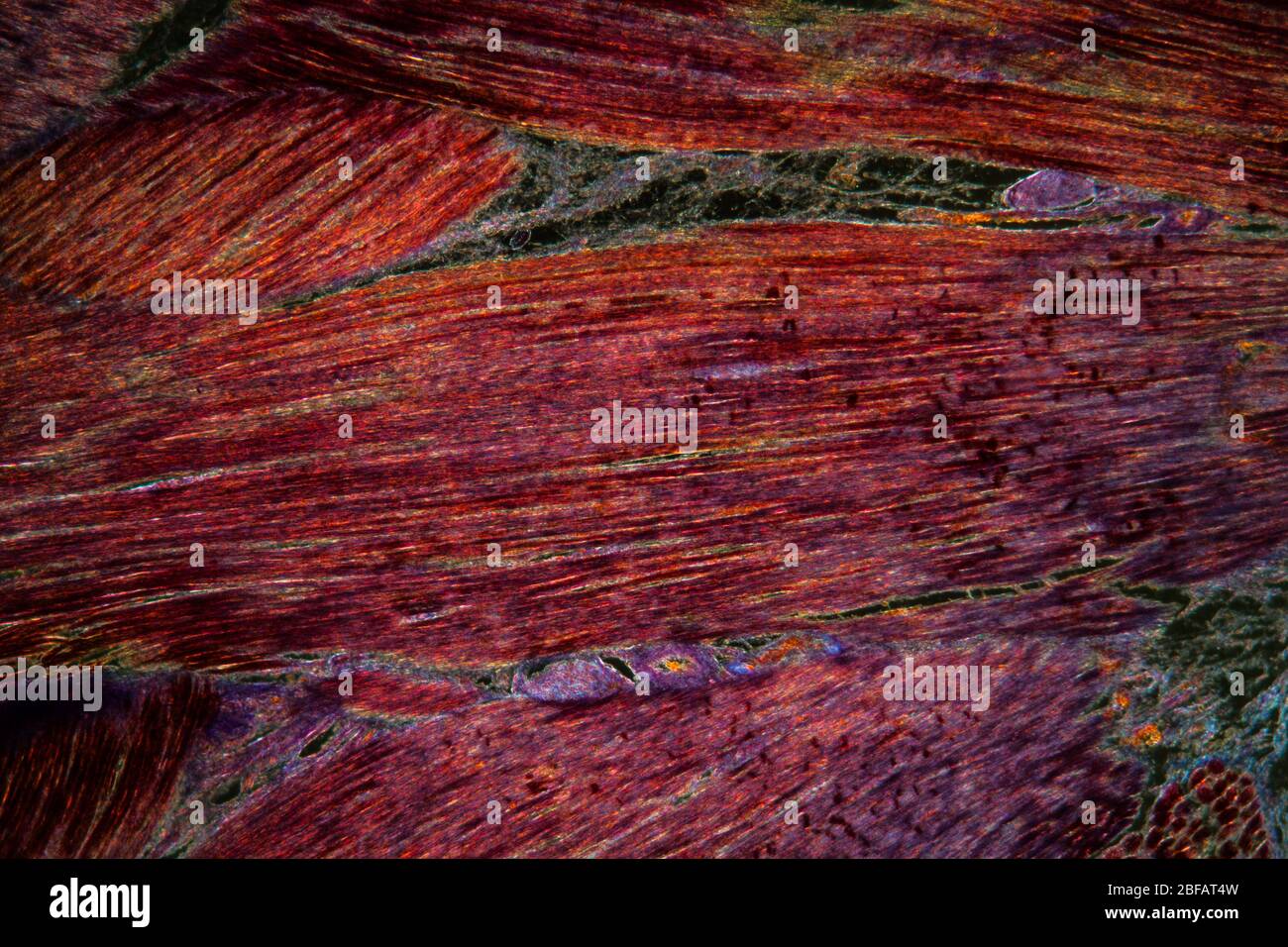 Muscle tissue with collagen increases 100x Stock Photo - Alamy