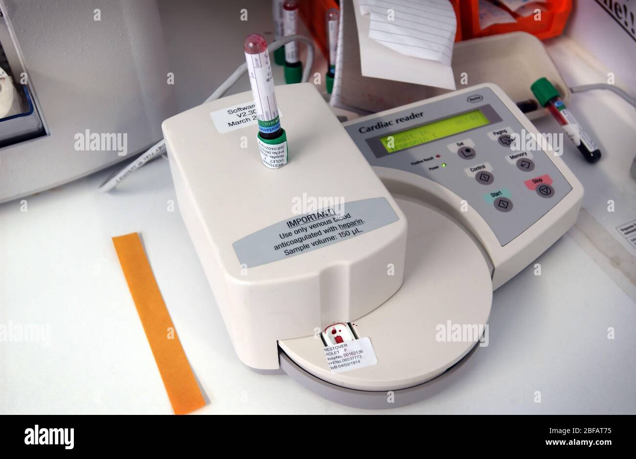 Troponin t test hi-res stock photography and images - Alamy