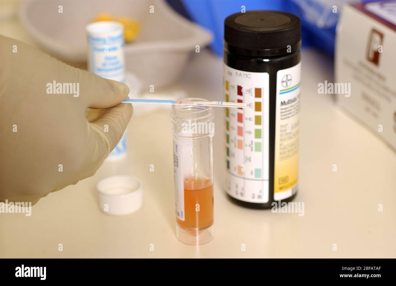 A nurse uses a Multistix (multiple stick test) to compare urine against ...