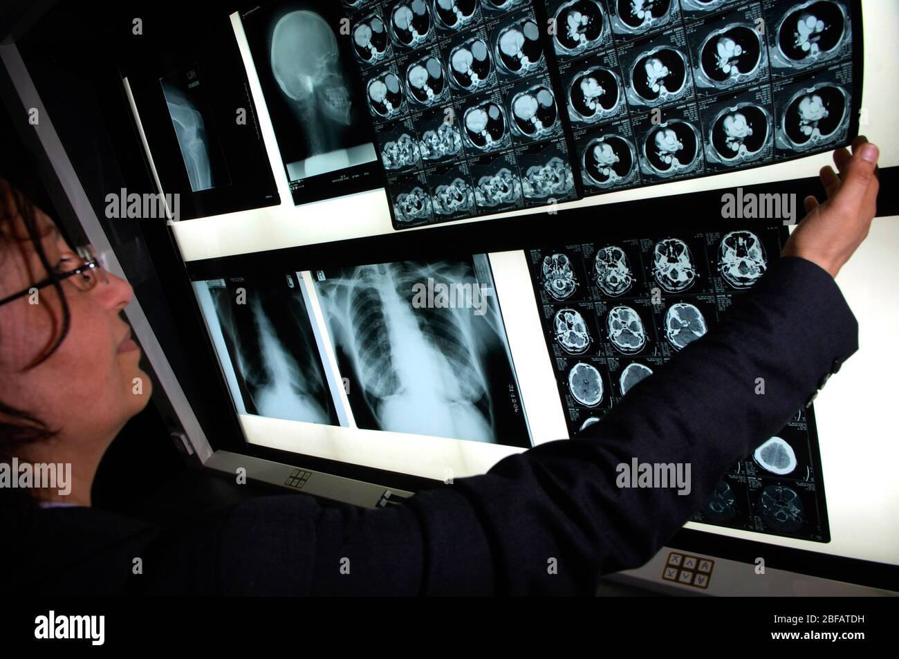 X ray light box hi-res stock photography and images - Alamy