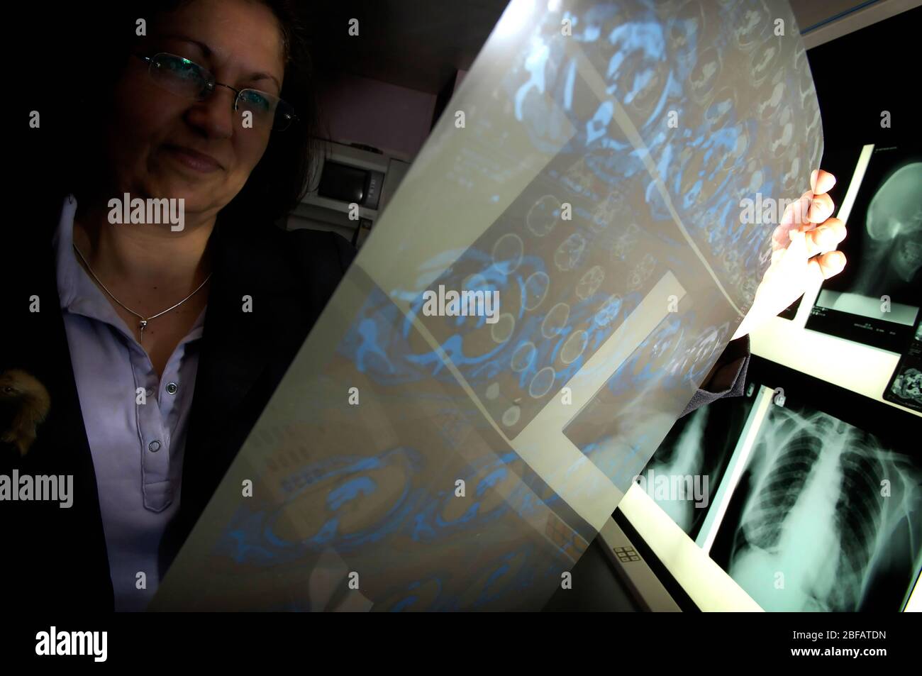 The Radiologist Examines the X-Rays (Medicimage)(Model Released Stock ...