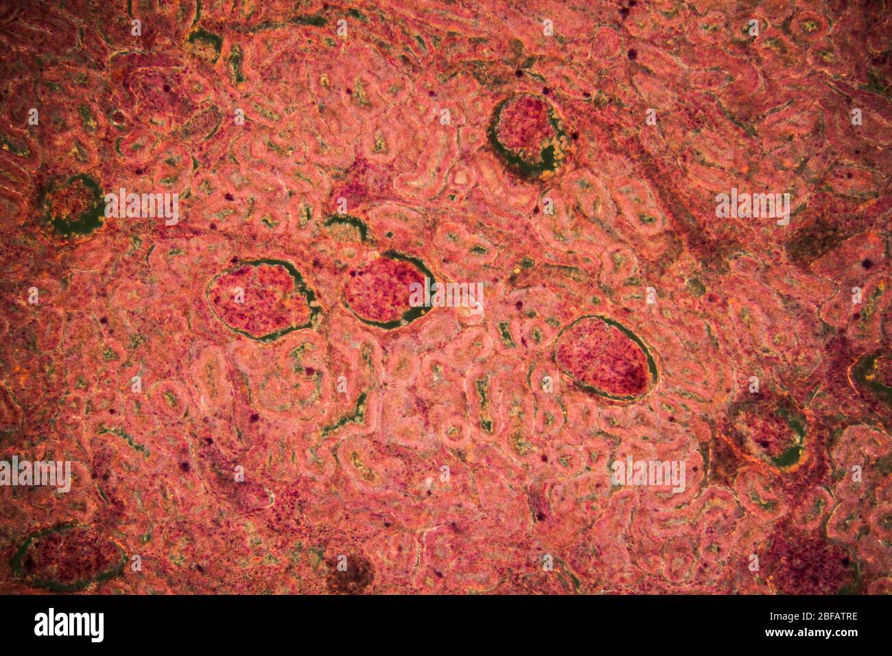 Kidney tissue with kidney bodies across 100x Stock Photo - Alamy