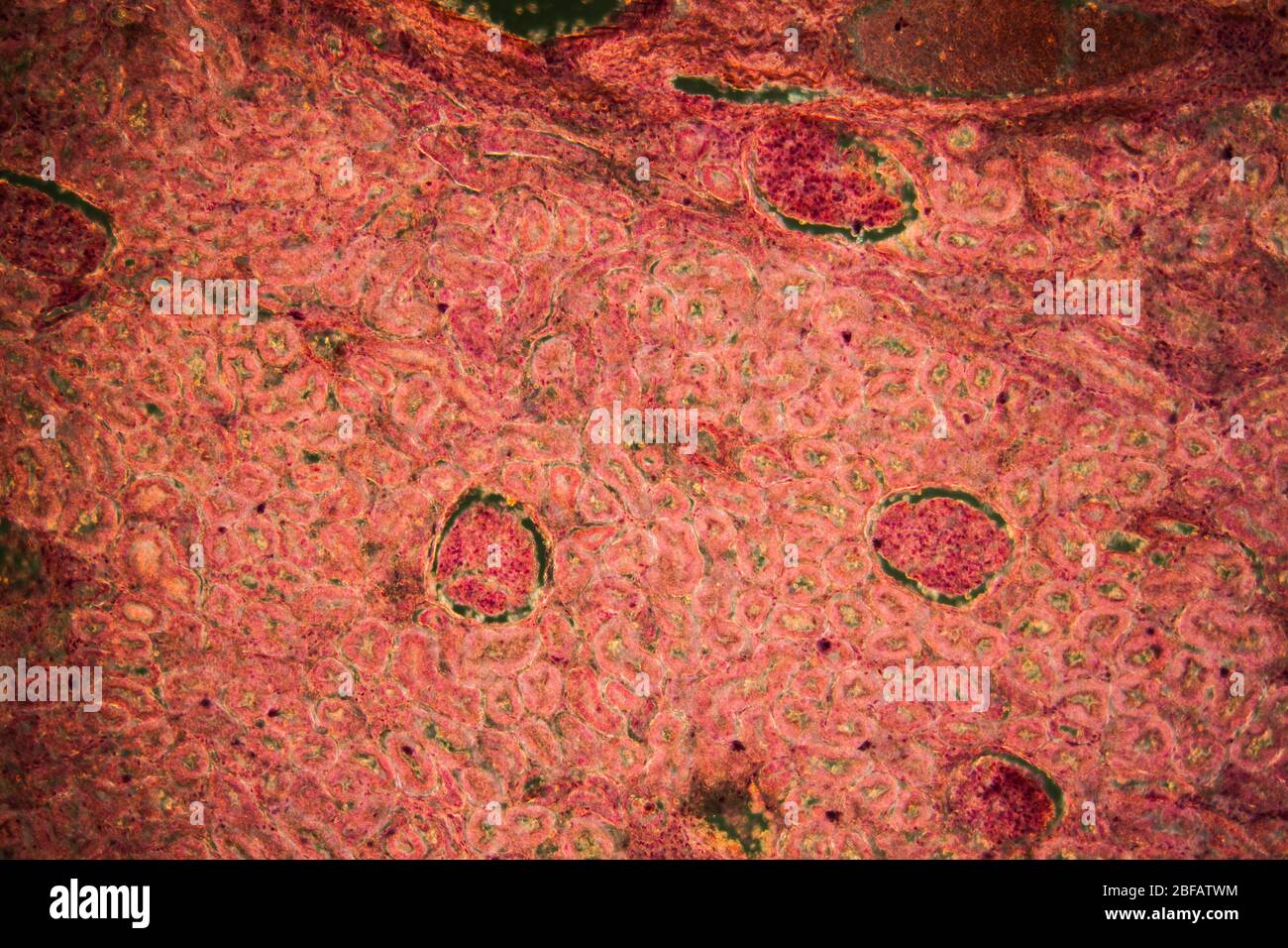 Kidney tissue with kidney bodies across 100x Stock Photo - Alamy