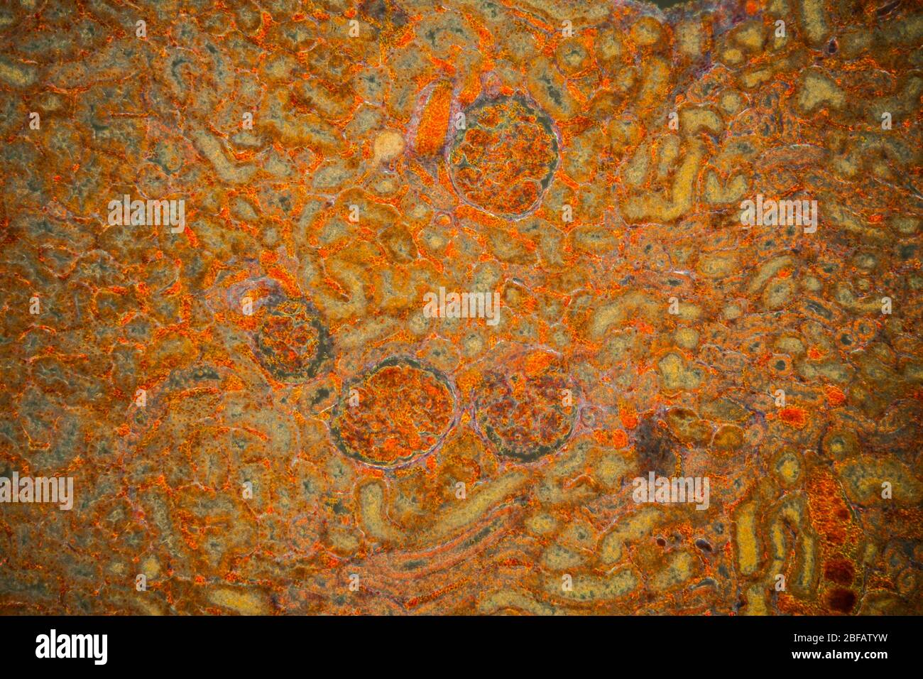 Corpuscles hi-res stock photography and images - Alamy