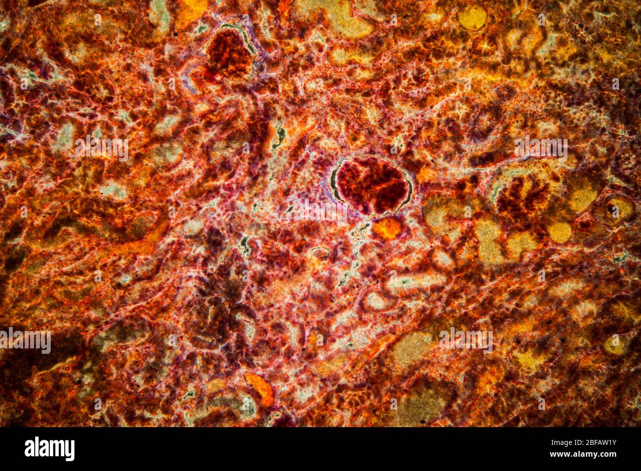 Kidney tissue with kidney corpuscles with bleeding 100 times Stock ...