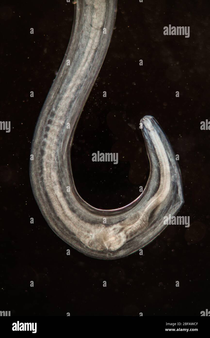 Parasite Worm Microscope