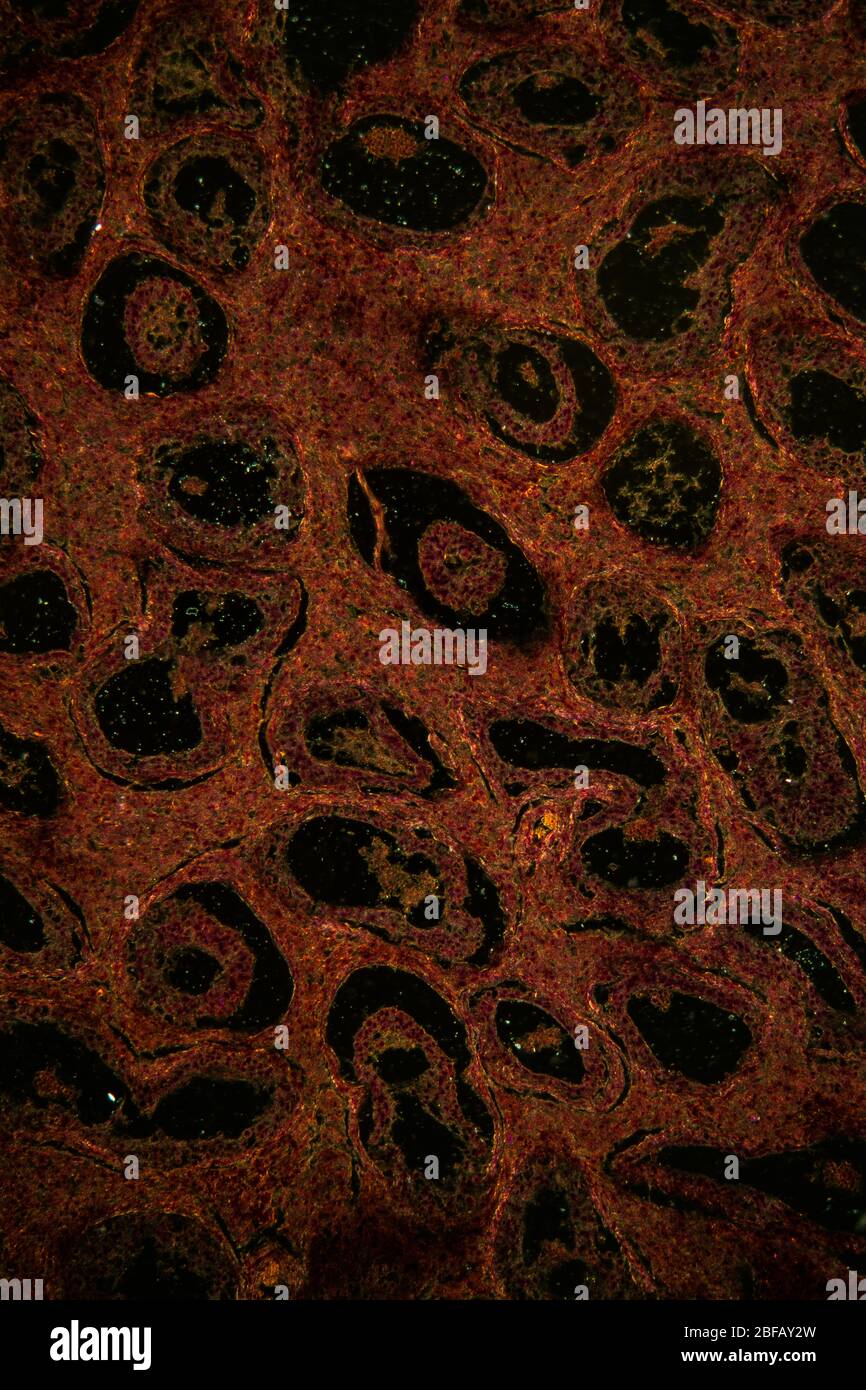 Inguinal testicle tissue under the microscope 100x Stock Photo - Alamy