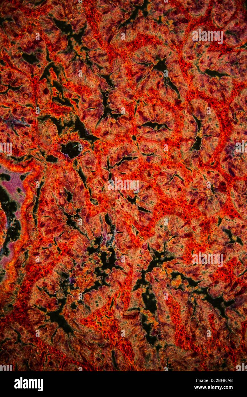 Spider gland with garden cross spider 100x Stock Photo - Alamy