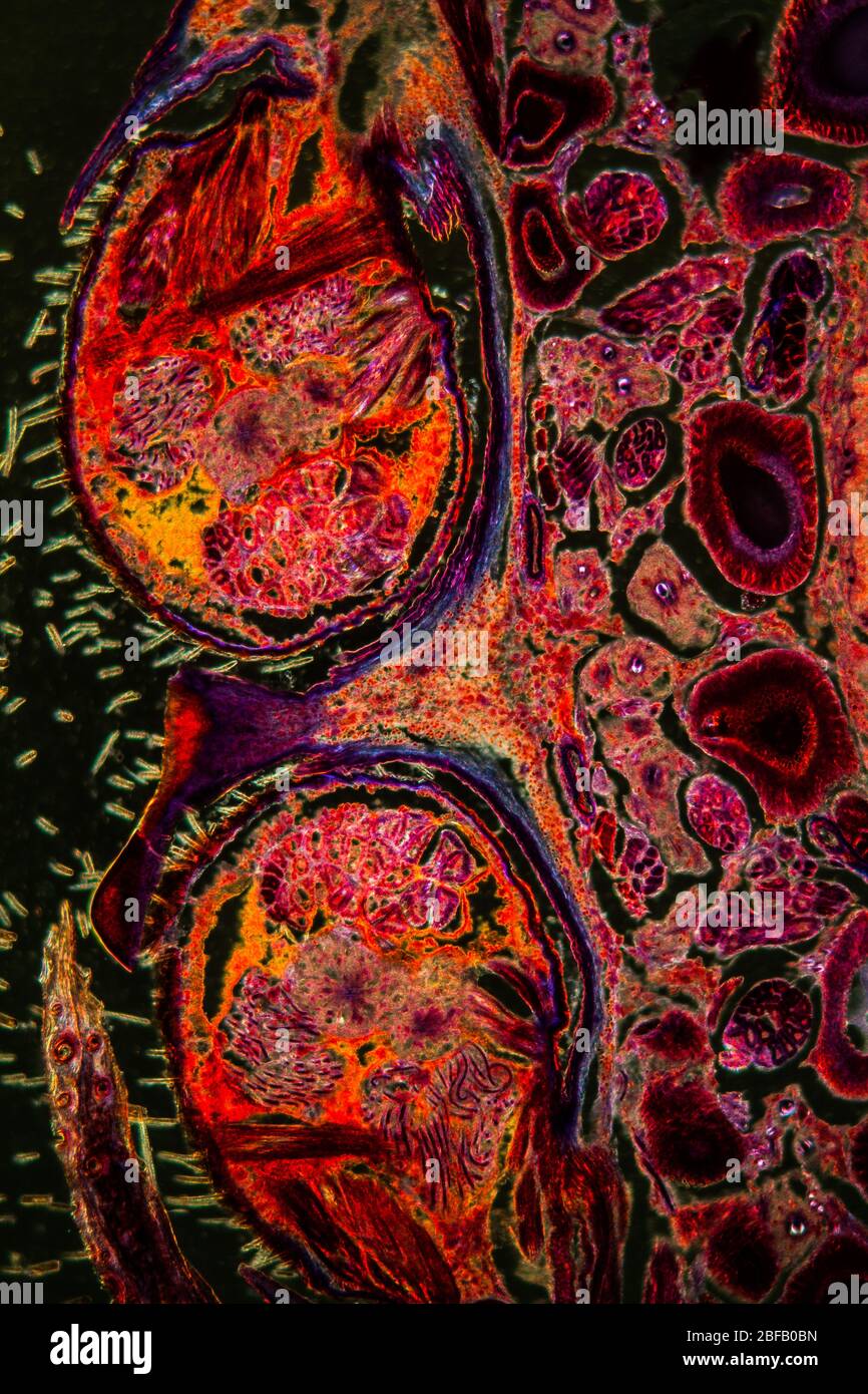 Spider gland with garden cross spider 100x Stock Photo - Alamy