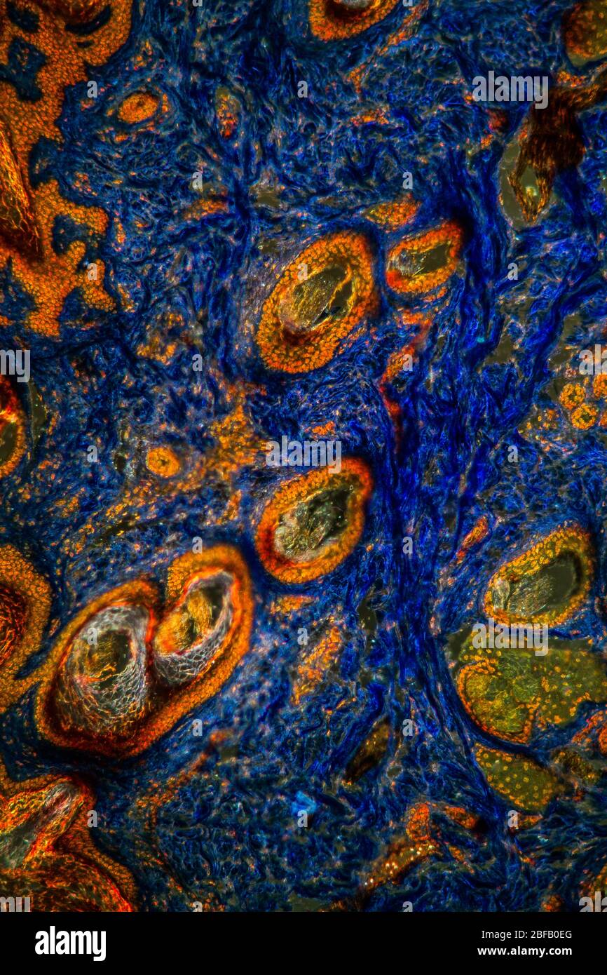 Scalp with hair roots under the microscope 100x Stock Photo - Alamy