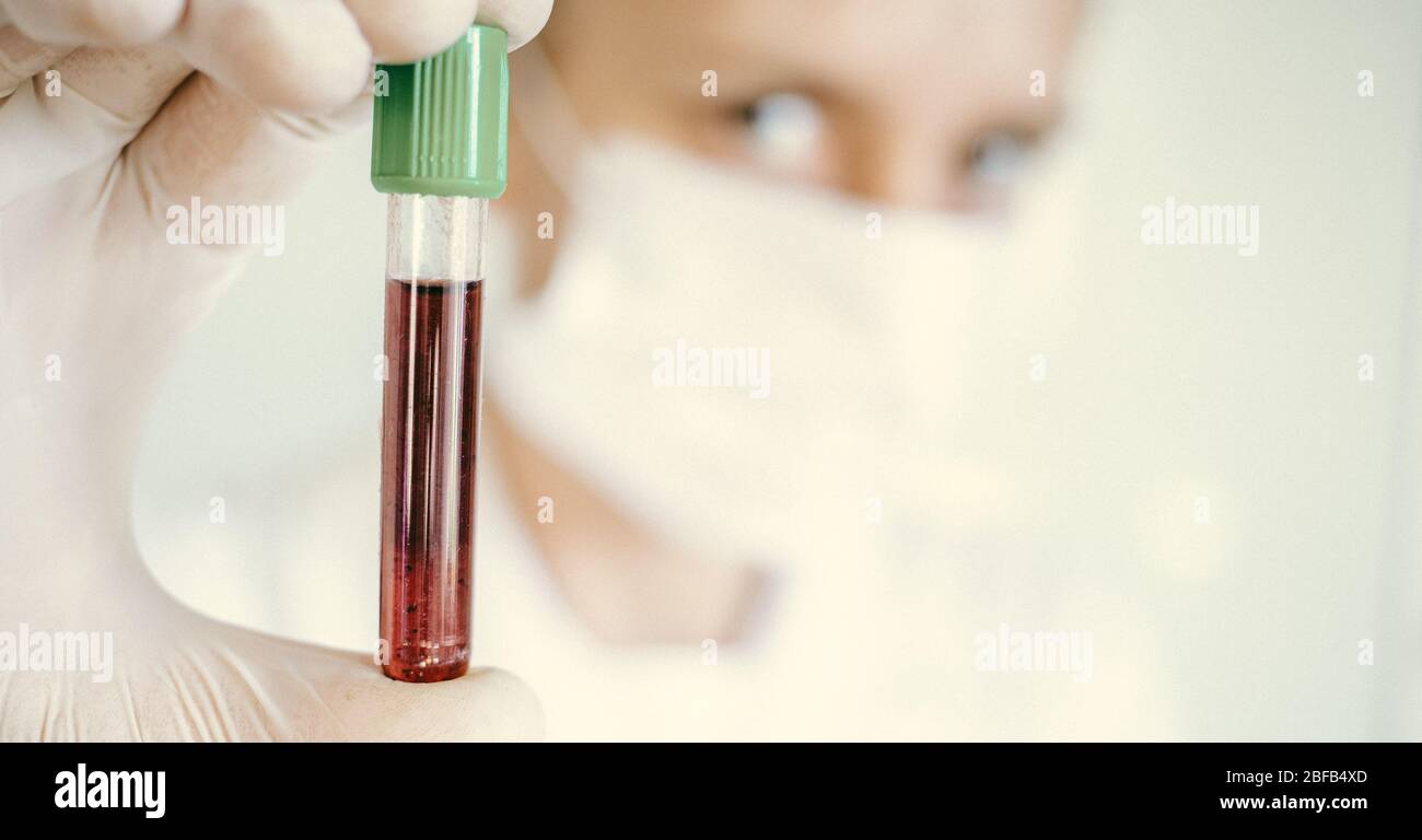 female doctor holding a blood test sample coronavirus Stock Photo - Alamy