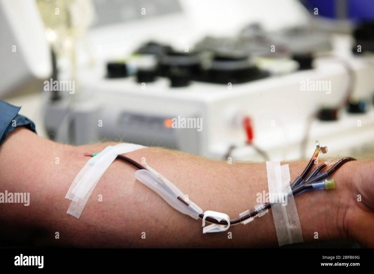 Haemonetics mcs machine hi-res stock photography and images - Alamy