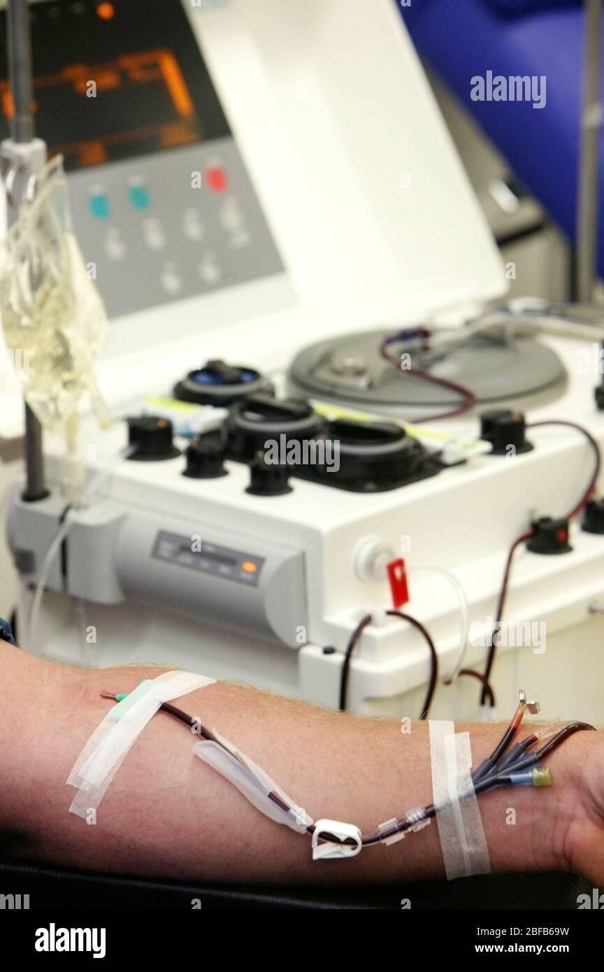 The Haemonetics MCS machine collects whole blood from a healthy donor ...