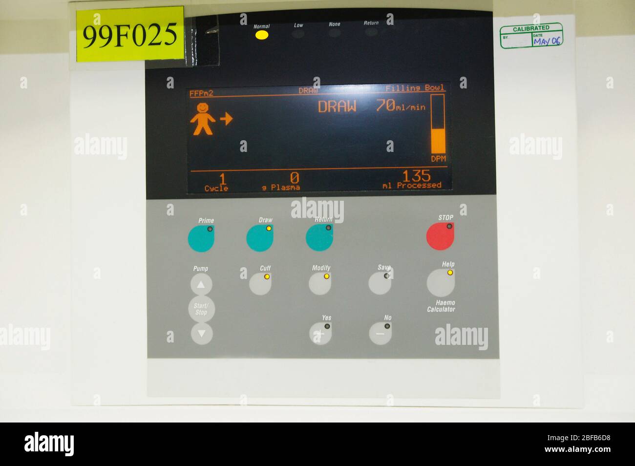 Haemonetics mcs blood collection separation system hi-res stock ...