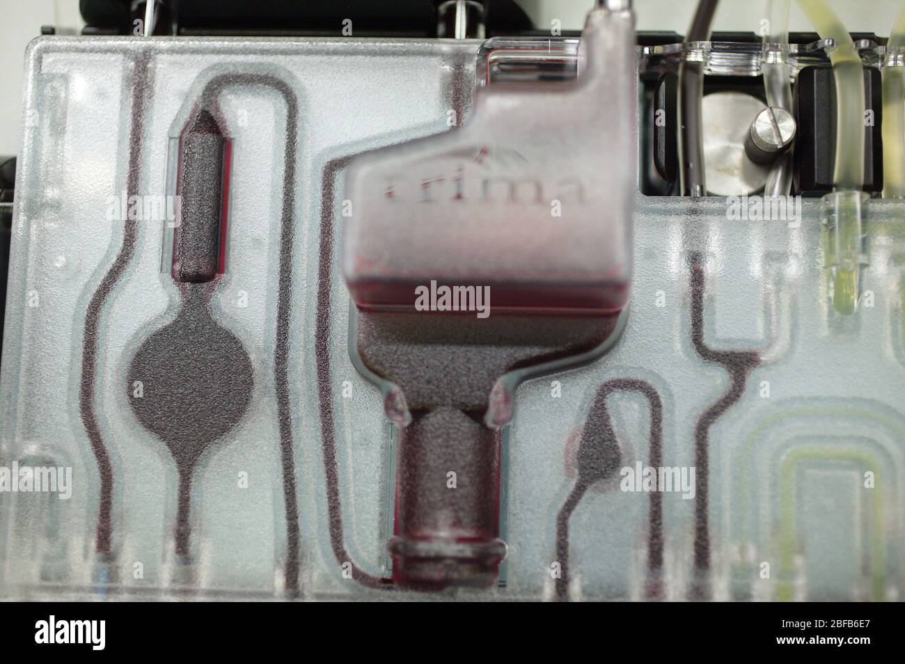 The Trima Accel. This is an online automated centrifuge used to ...