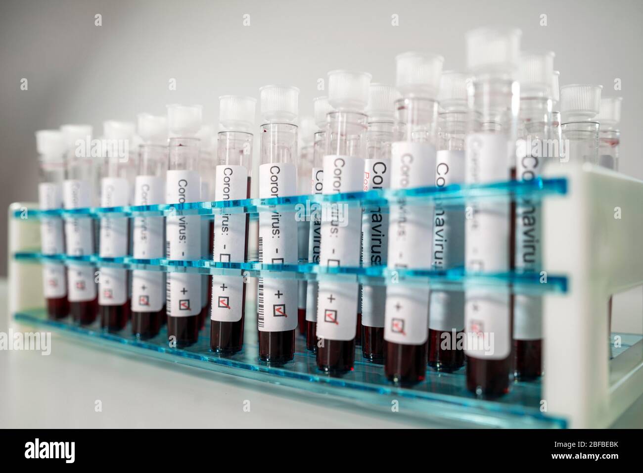 Test tube holder hi-res stock photography and images - Alamy