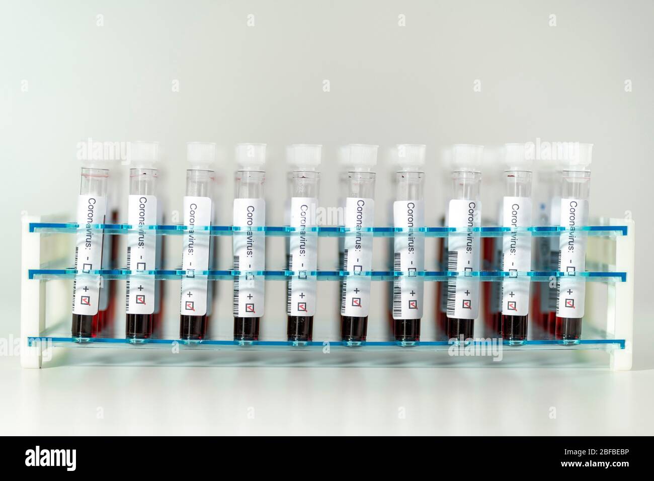 Test tube holder hi-res stock photography and images - Alamy