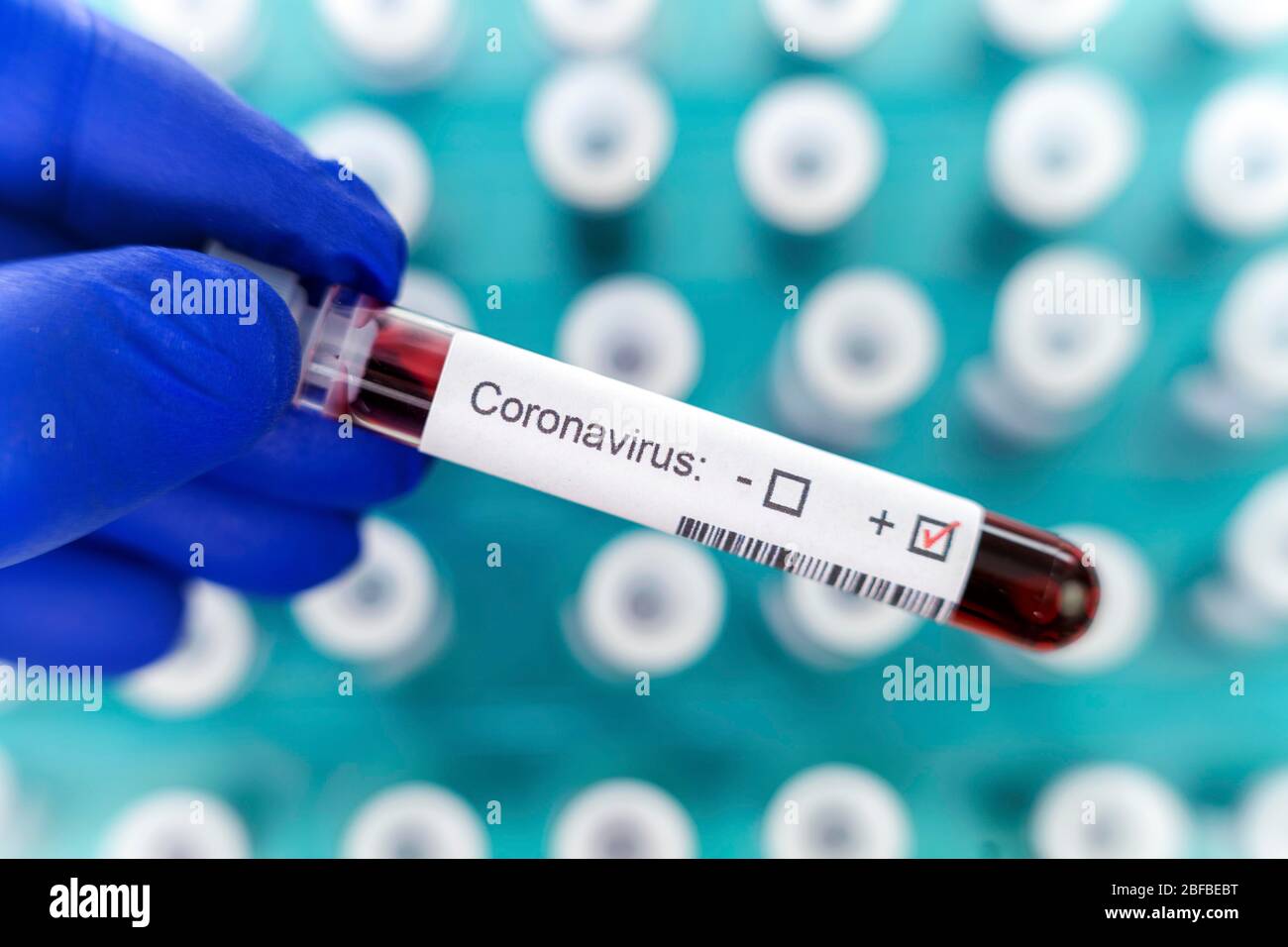 Positive laboratory hi-res stock photography and images - Alamy