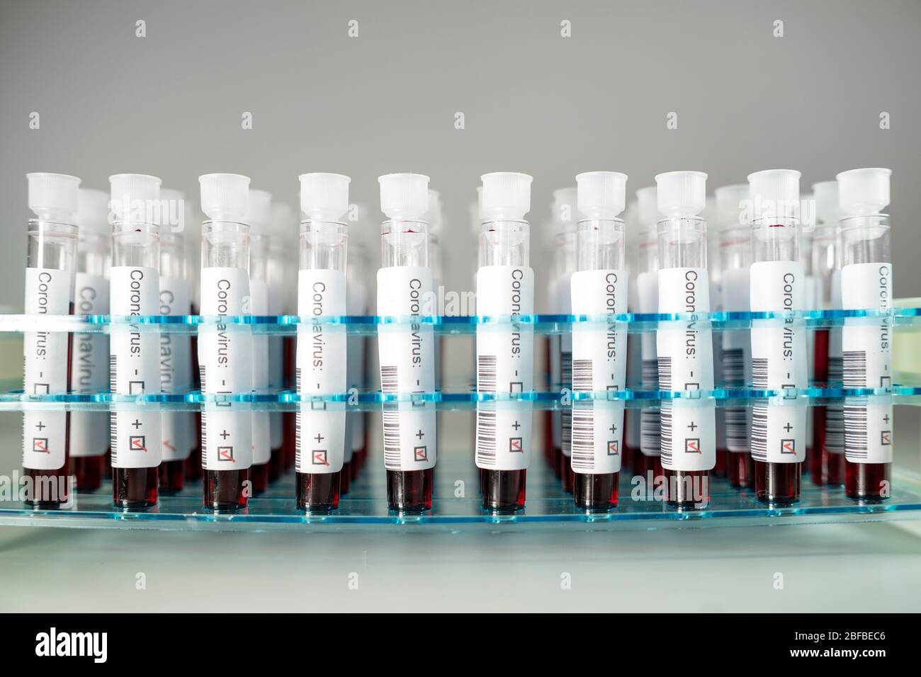 Test tube holder hi-res stock photography and images - Alamy