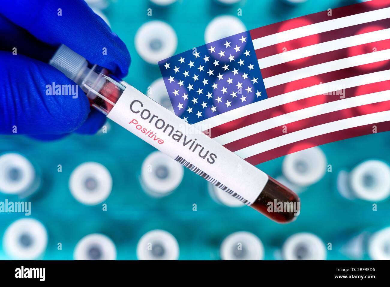 Flag of usa and many blood tube tests as a background hi-res stock ...