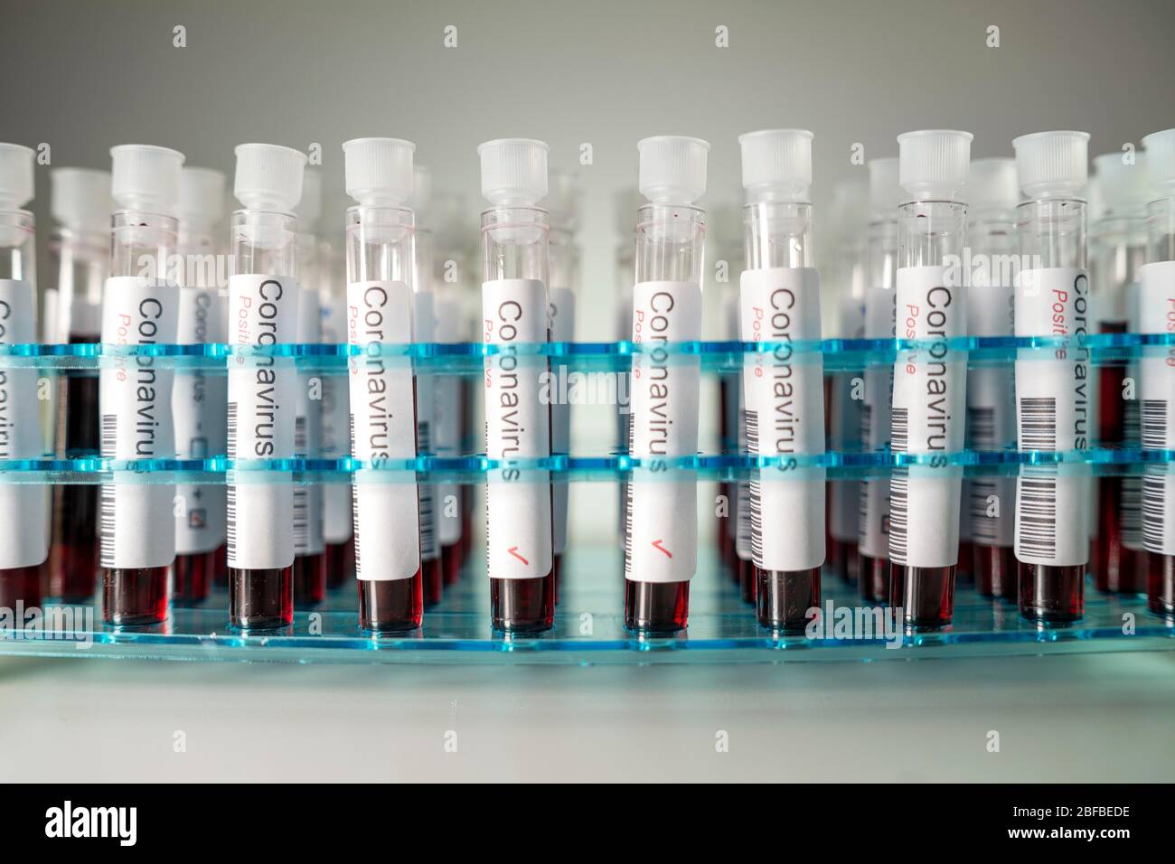 Test tube holder hi-res stock photography and images - Alamy