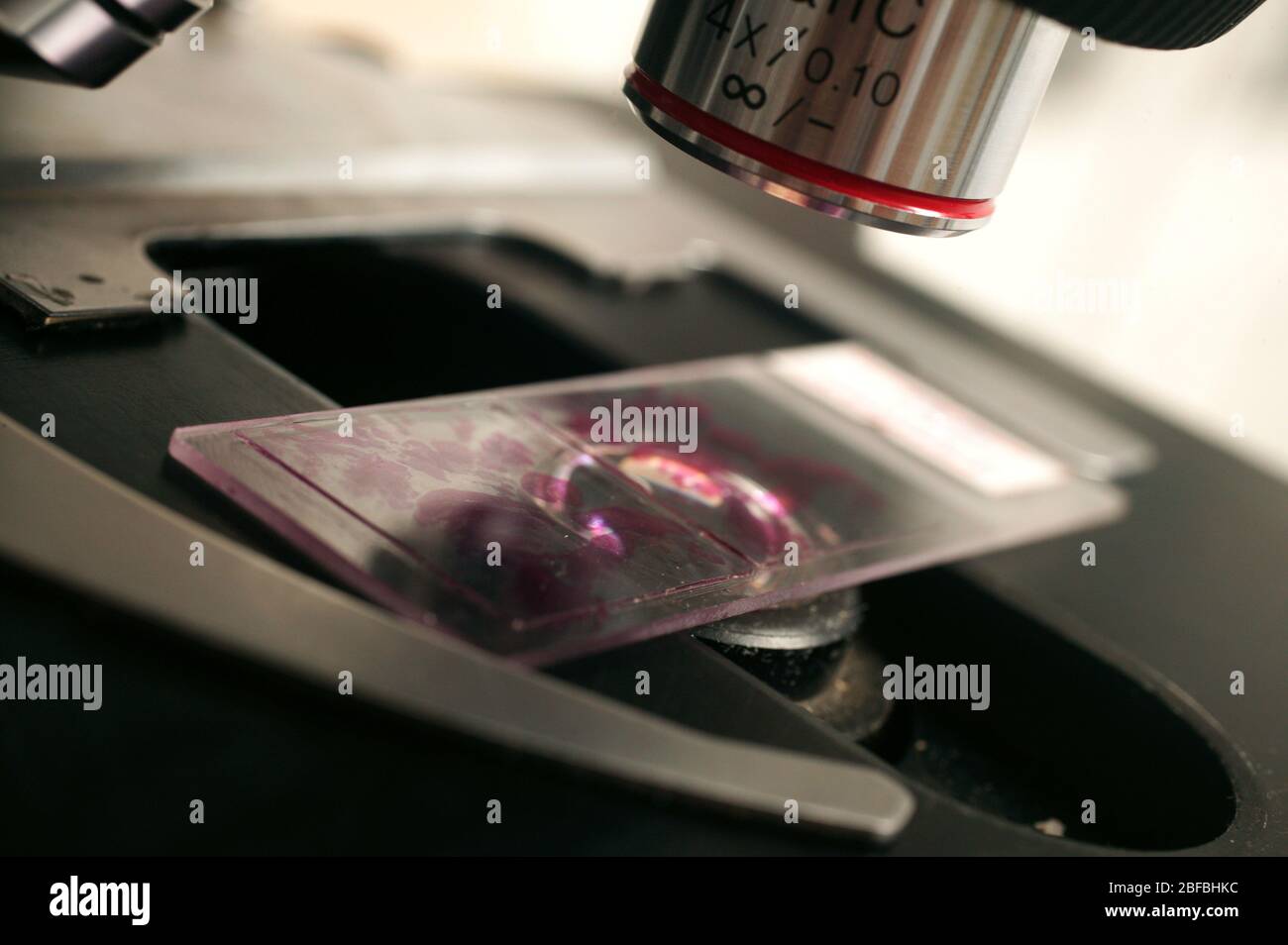 Cytology hi-res stock photography and images - Alamy