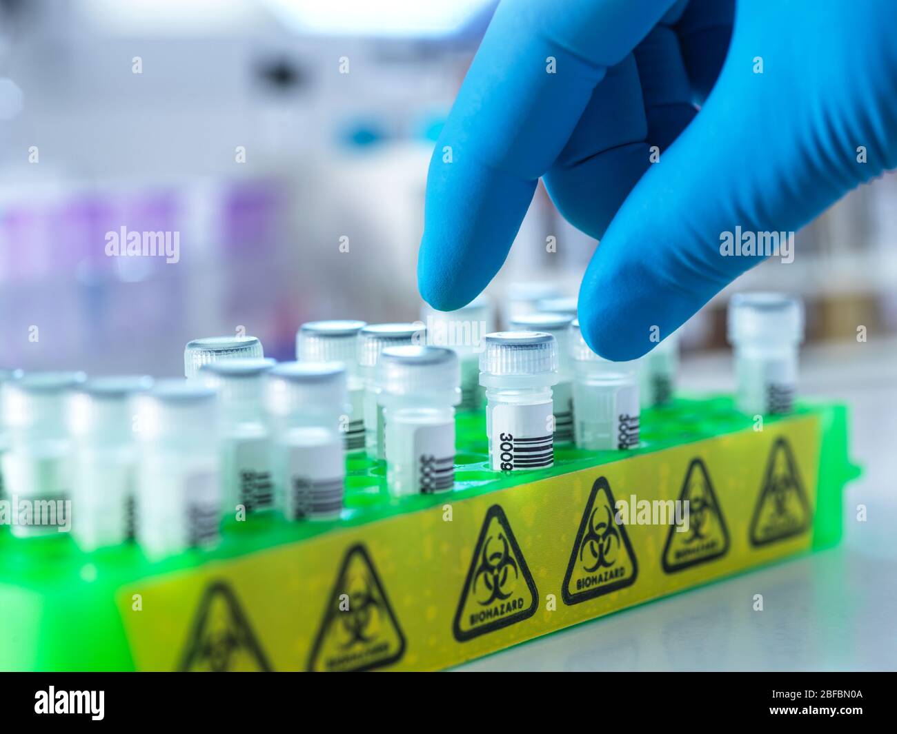 Sputum sample hi-res stock photography and images - Alamy