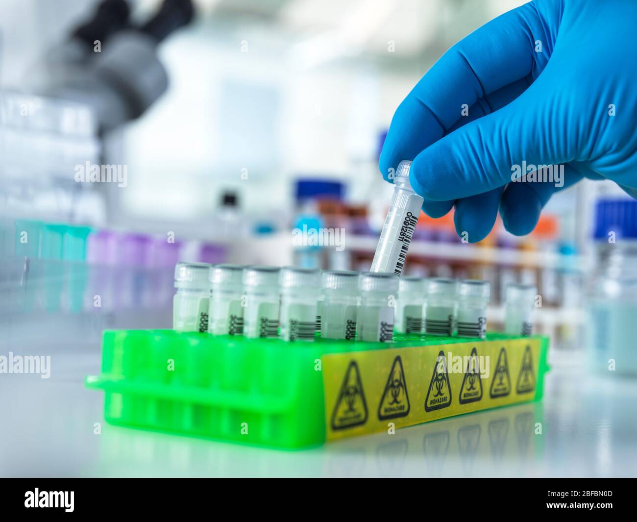 Sputum sample hi-res stock photography and images - Alamy