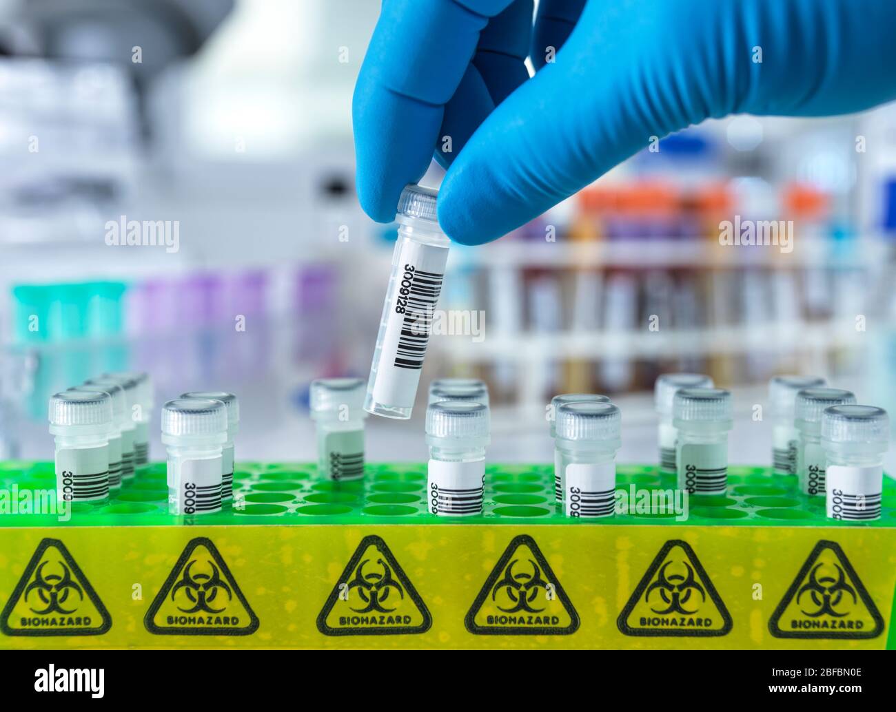Medical sputum sample hi-res stock photography and images - Alamy