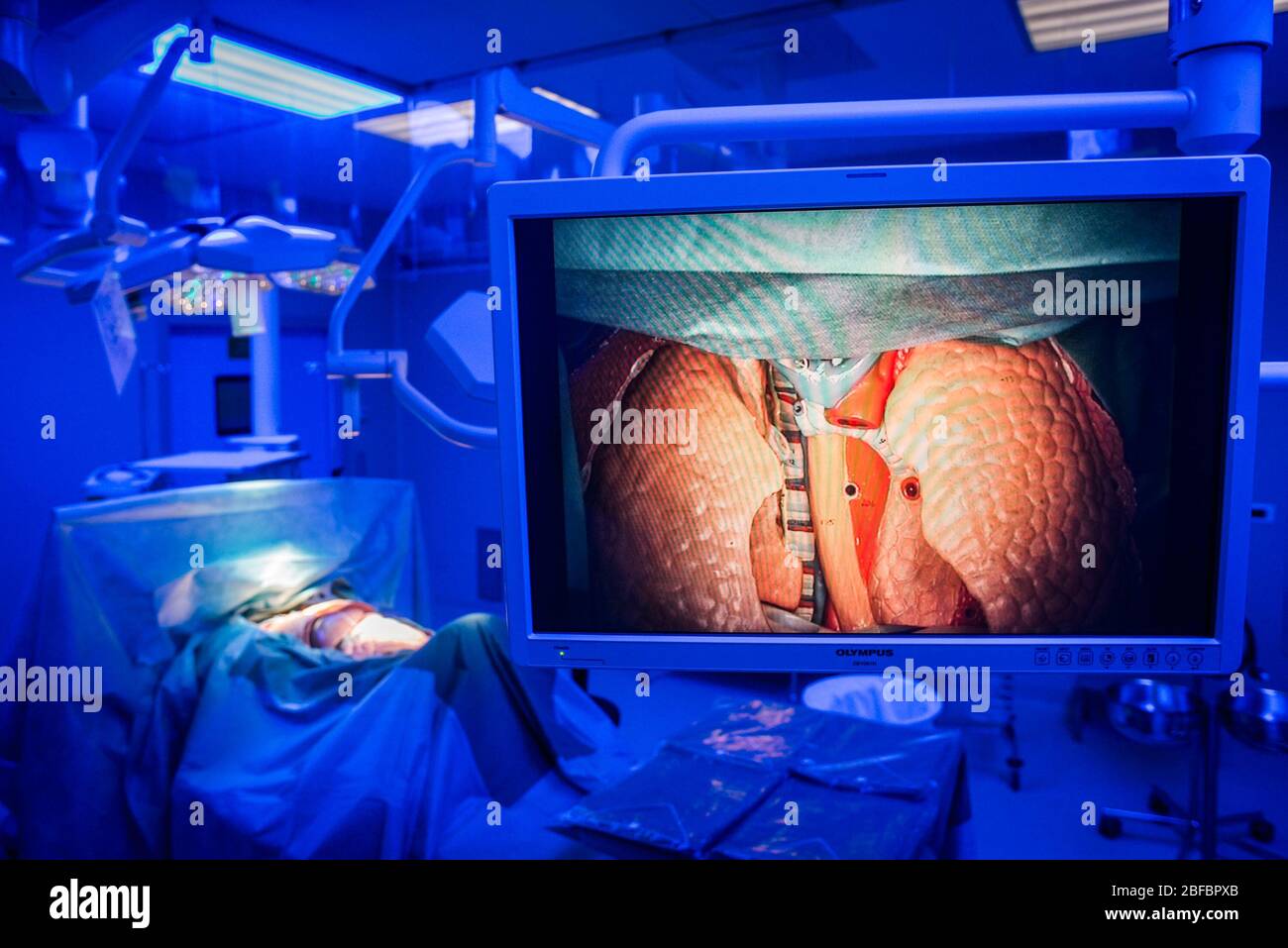 New operation hi-res stock photography and images - Alamy