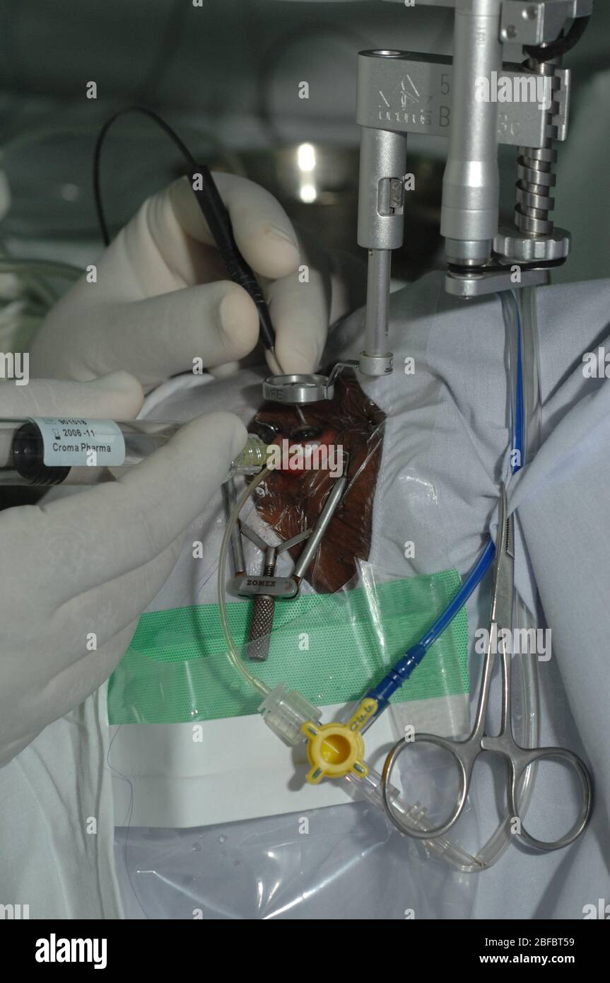 Oil is infused into the wound to support the eye in place of the ...