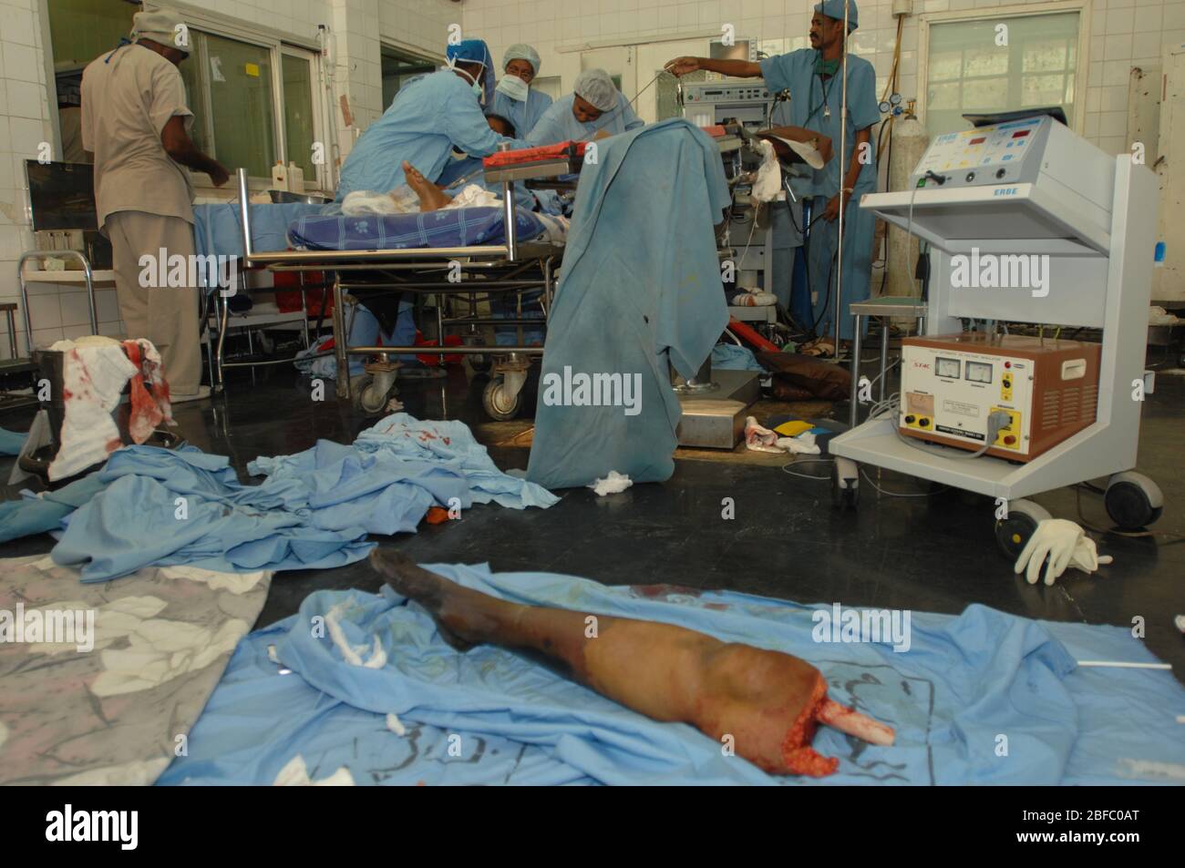 Alone amputation hi-res stock photography and images - Alamy