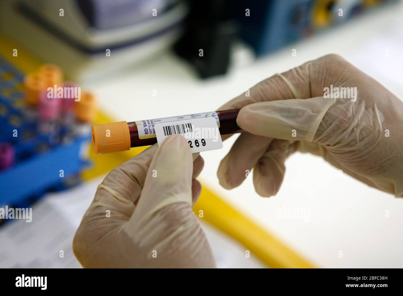A pathologist labels blood samples in a test tube Stock Photo - Alamy