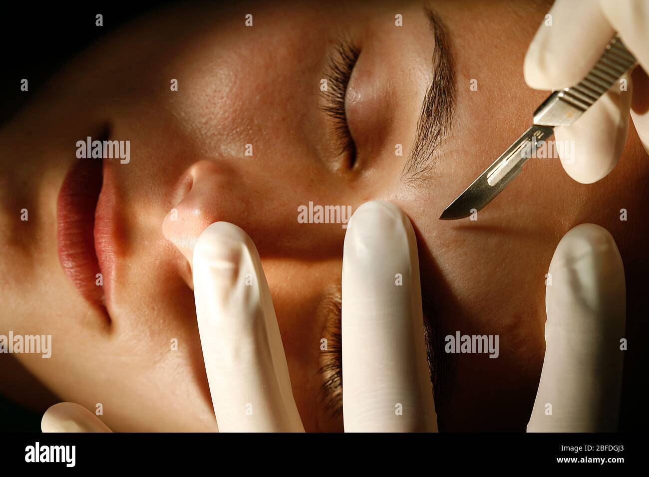 Gloved hands prepares to make the first incision on the forehead of a ...