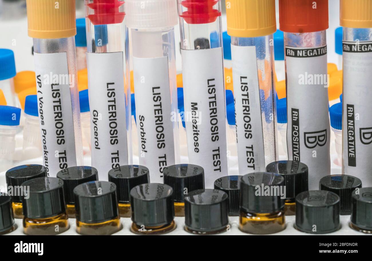 Listeria monocytogenes petri hi-res stock photography and images - Alamy