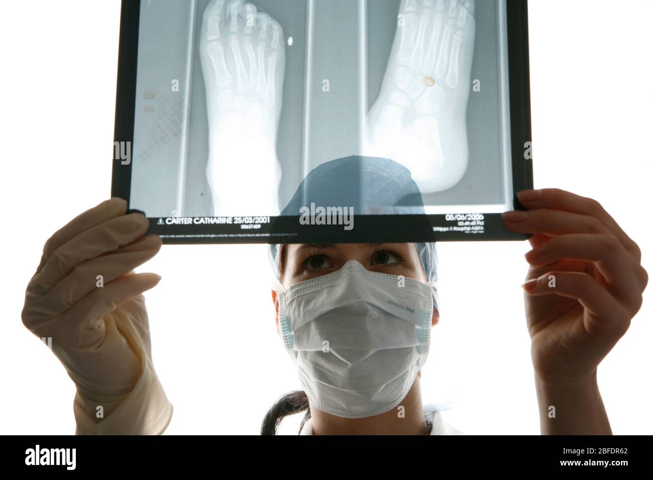 X ray of the foot hi-res stock photography and images - Alamy
