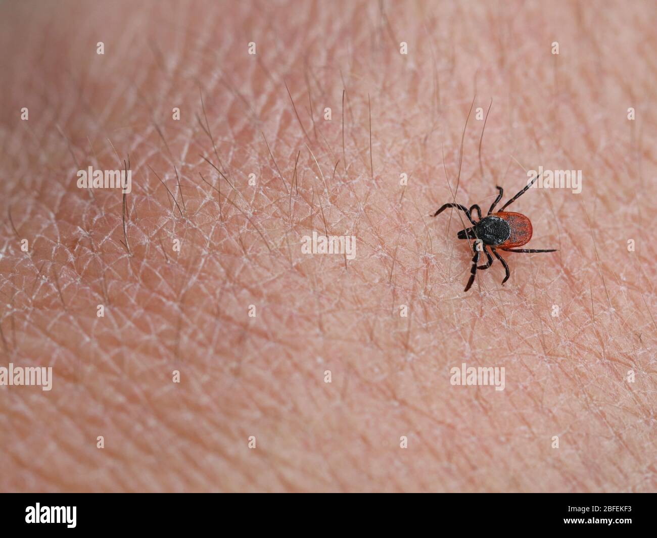 deer tick, ixodes ricinus, on human skin background with copy space ...